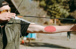 How to Treat a Bruise from Bow String Slap [Solved]